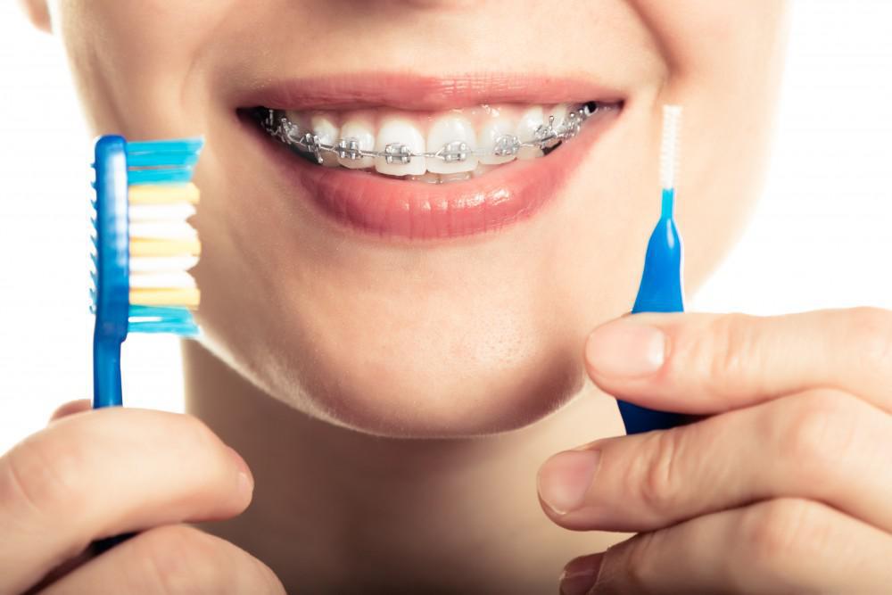 Tips and Tricks for Keeping Your Braces Clean | Lansdowne Orthodontics